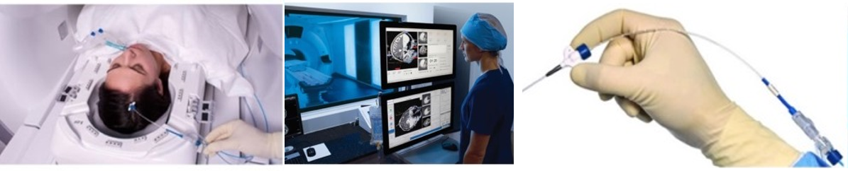 Visualase | Hôpital Necker-Enfants malades