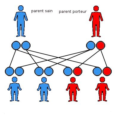 [Revue de presse] Nanisme : définition, symptômes, traitement et ...